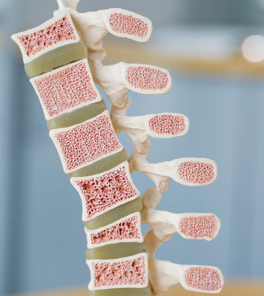 Multiples Myelom